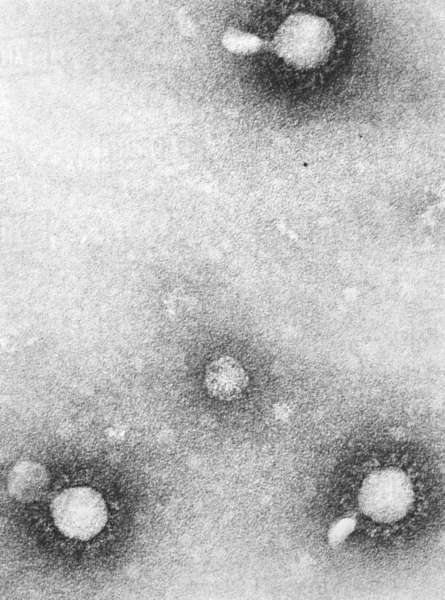 TEM of Venezuelan equine encephalitis (VEE) virus - Stock Photo - Dissolve
