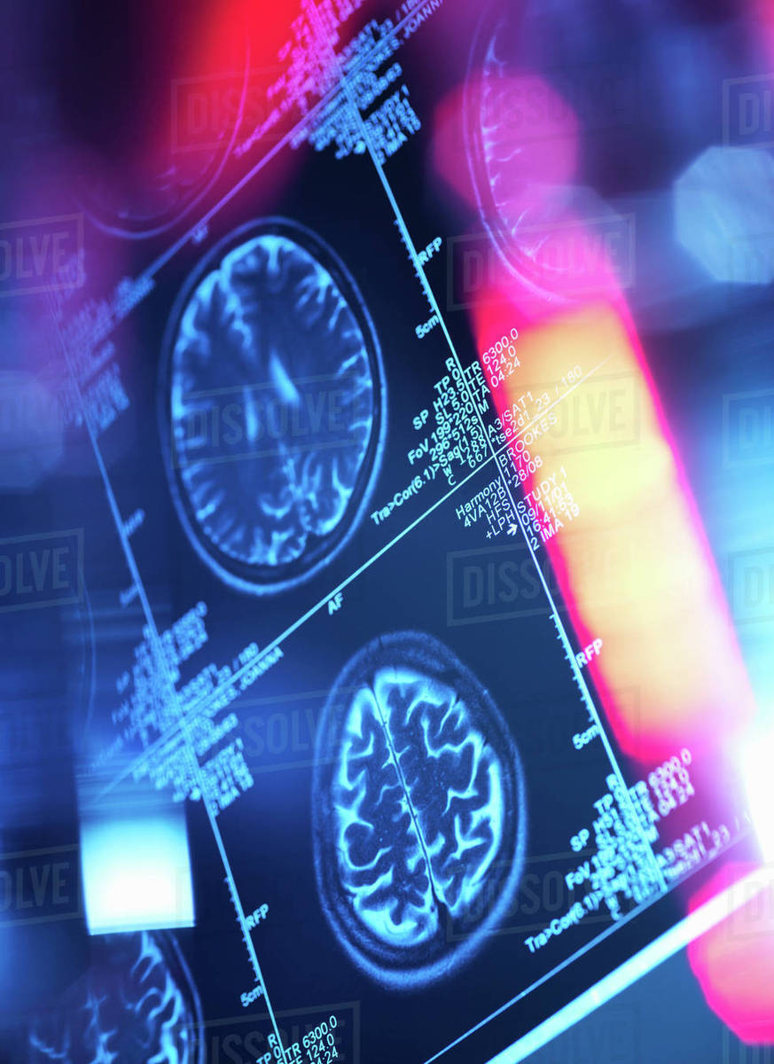 Human brain scan in a neurology clinic - Royalty-free Stock Photo ...