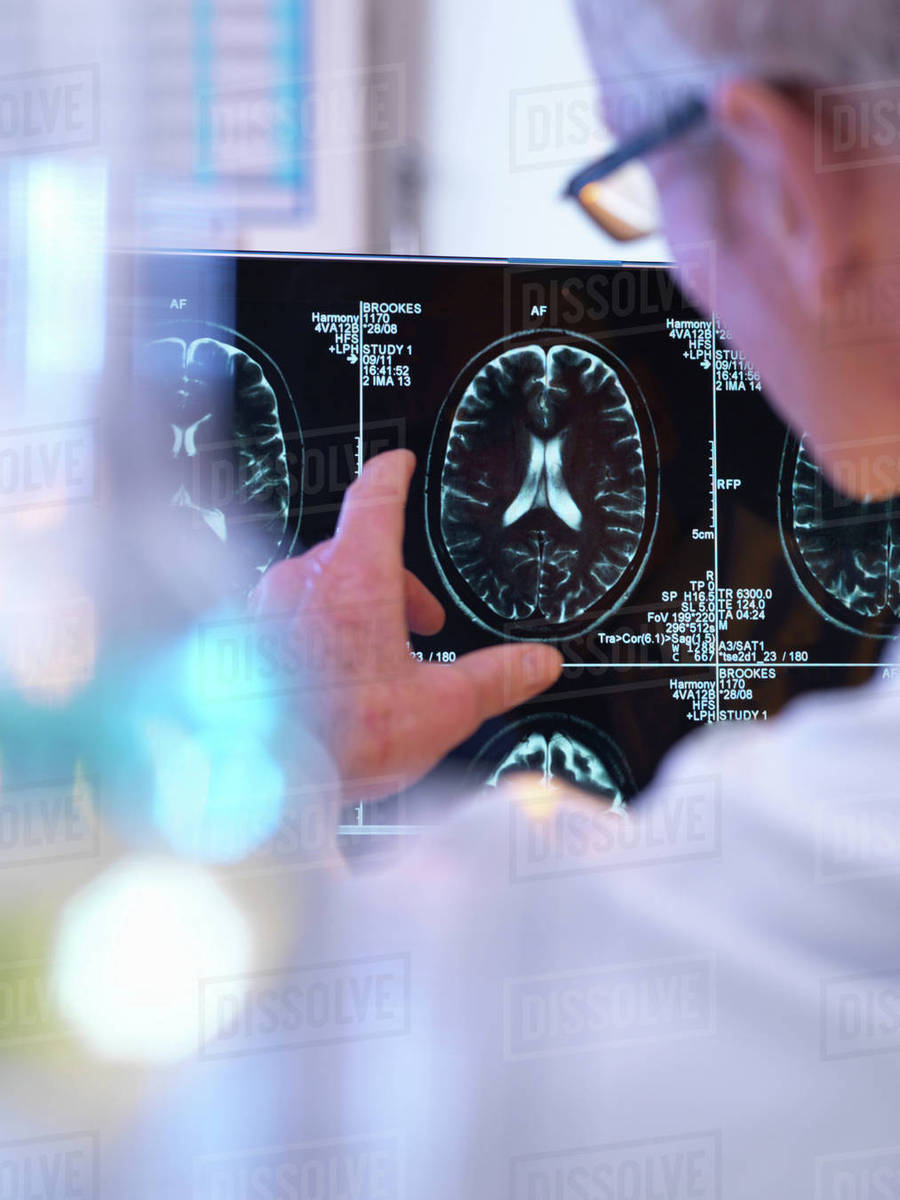 Radiologist assessing CT brain scan - Stock Photo - Dissolve