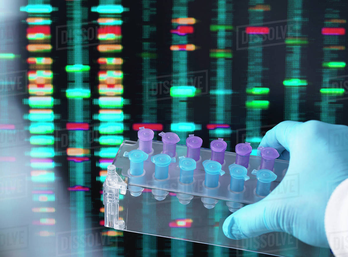 DNA Research, Scientist holding up a tray of DNA samples with results ...