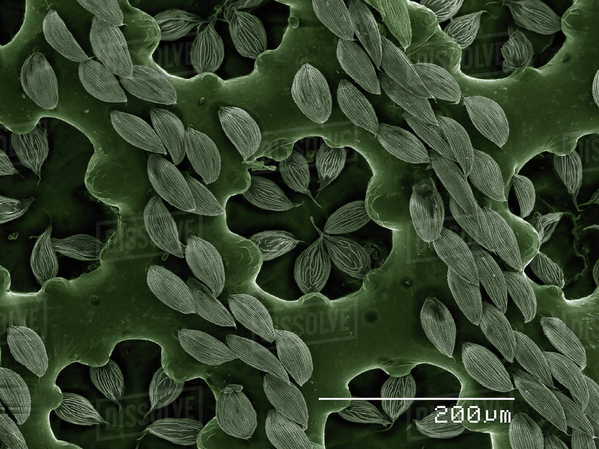 Detail of elytra of a recticulated beetle (Coleoptera: Cupedidae: Cupes ...