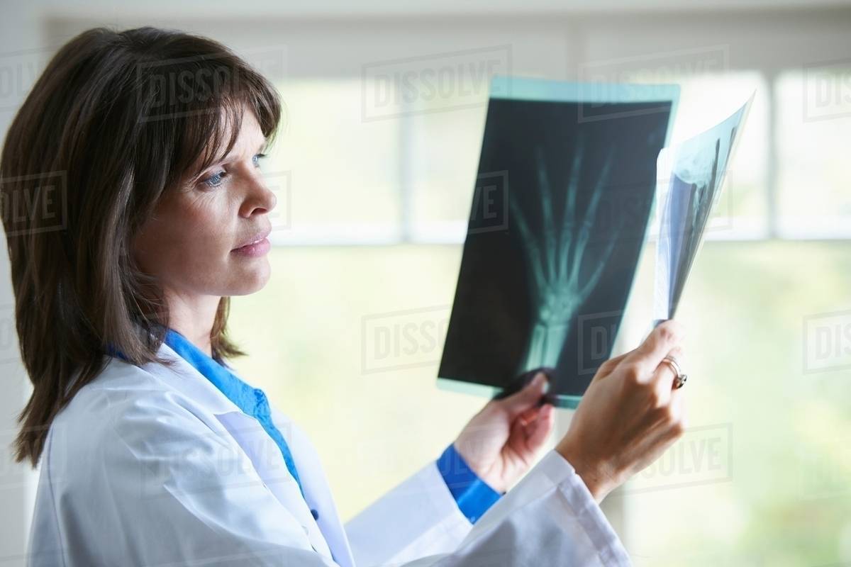 Doctor looking at xray image of hand - Stock Photo - Dissolve
