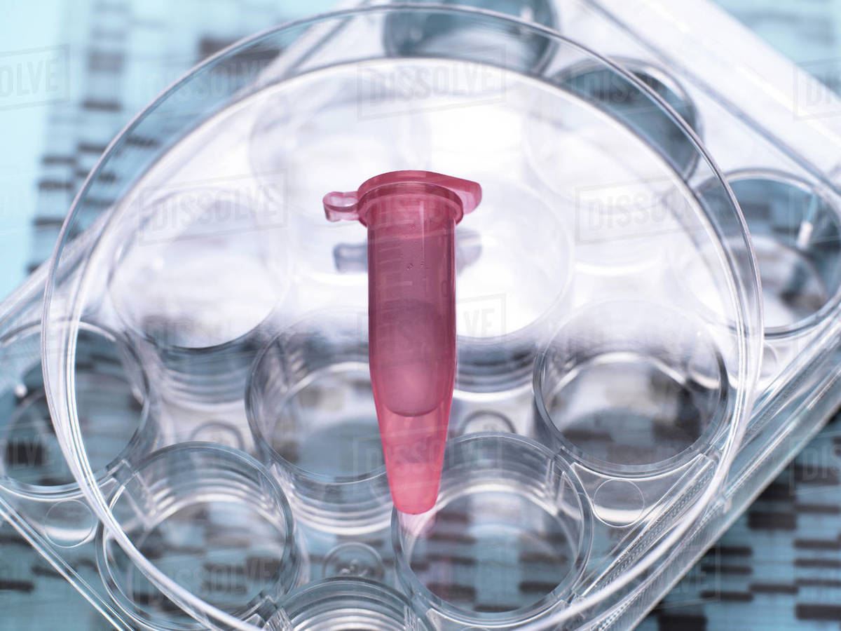 DNA sample inside vial on multi well plate, DNA gel showing results ...