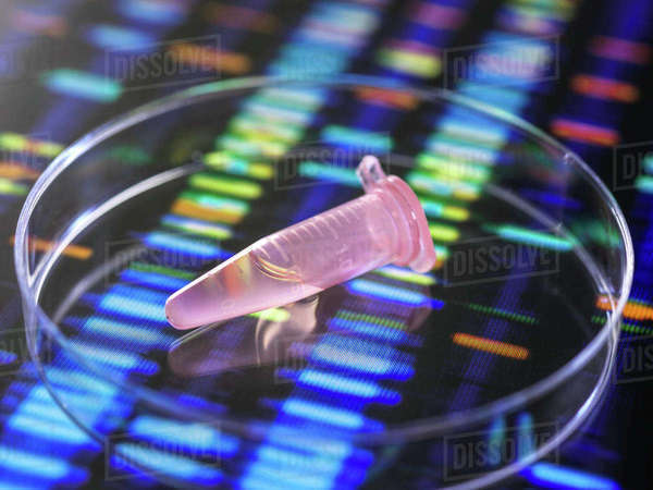 Close up of DNA samples in microcentrifuge tubes with the DNA profile ...