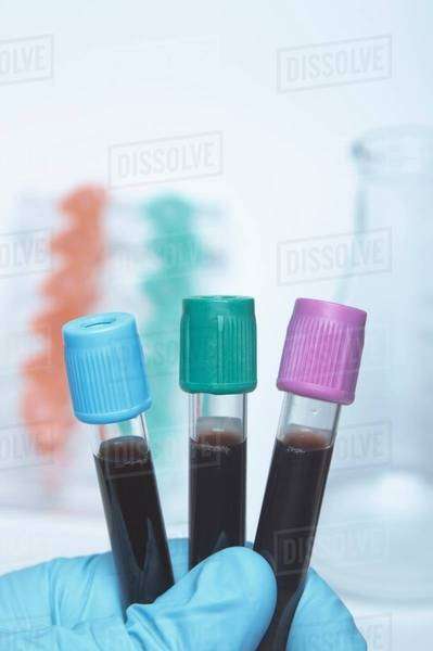 Color coded blood tubes containing synthetic blood samples. Blue top ...