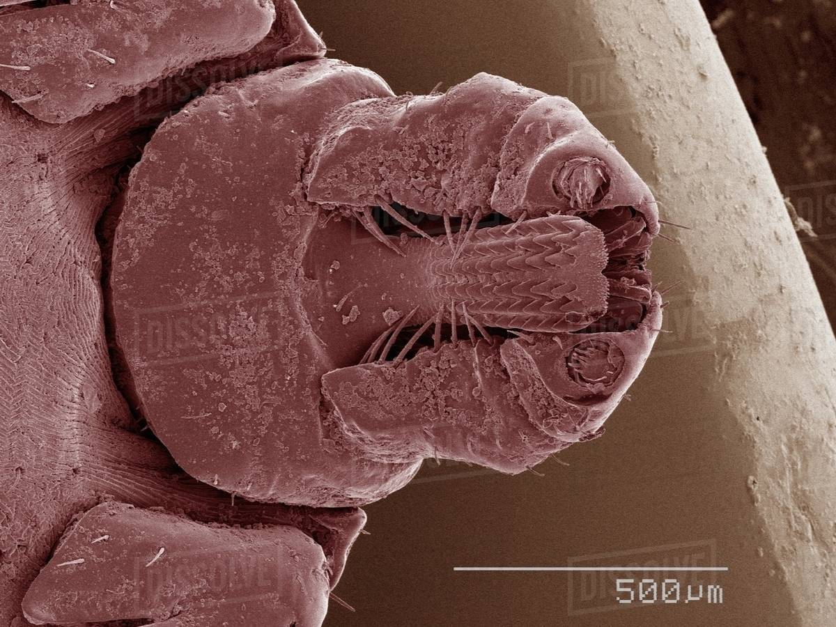 Coloured SEM of tick's mouthparts - Royalty-free Stock Photo | Dissolve