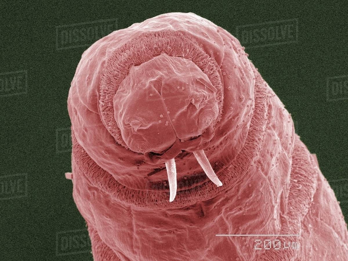 Coloured SEM of fly maggot mouthparts - Royalty-free Stock Photo | Dissolve