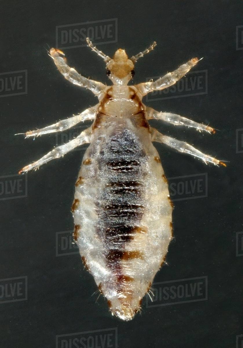 Dorsal view of a male body louse, Pediculus humanus var. corporis ...