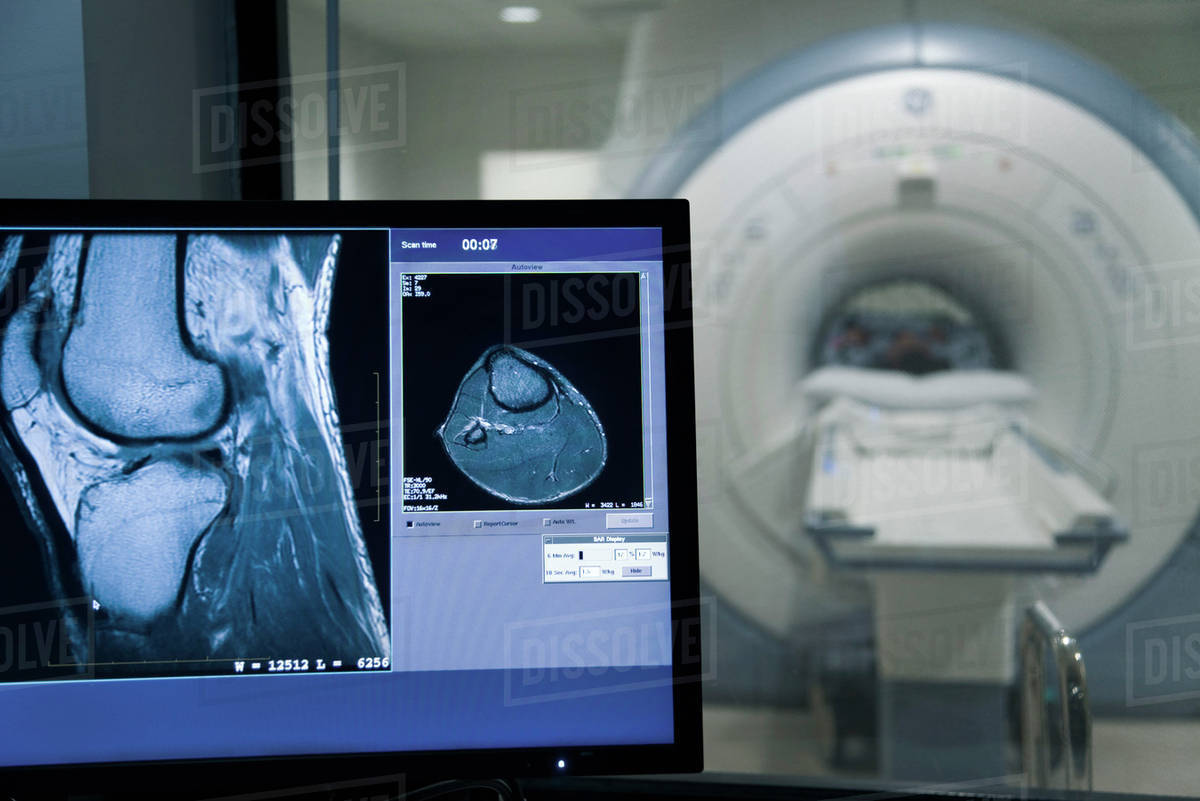 MRI scan result on computer monitor - Stock Photo - Dissolve