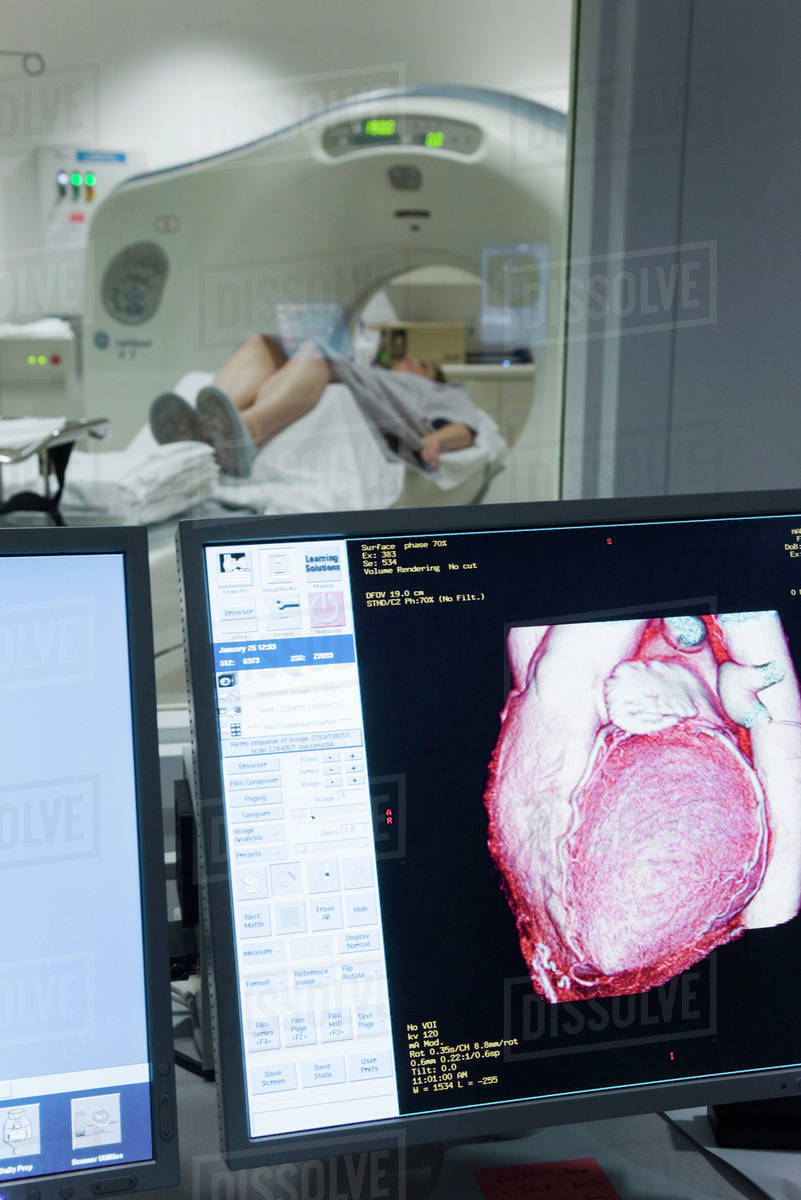 Patient's heart CAT scan result shown on monitor - Royalty-free Stock ...