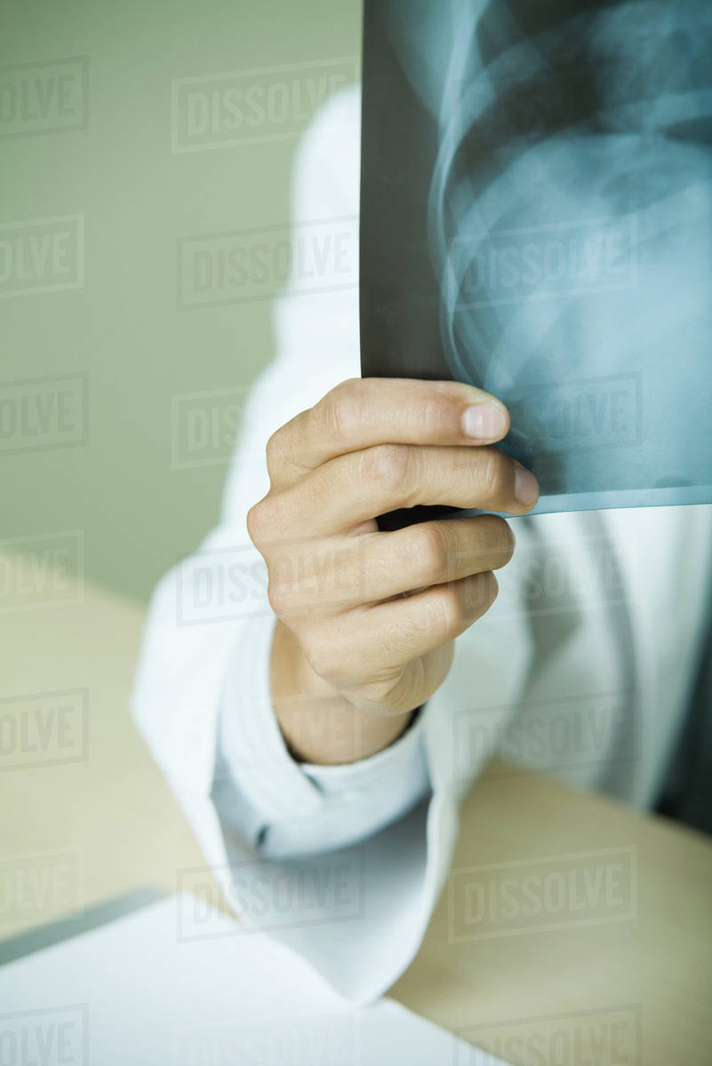 Doctor holding up x-ray of rib cage, partial view - Royalty-free Stock ...