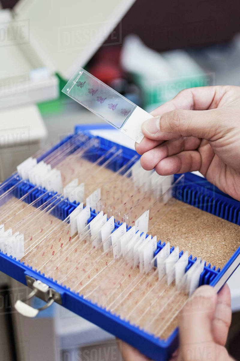 Scientist holding microscope slide over container at laboratory ...